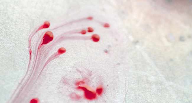Crime Scene Cleaners Boosbeck | Trauma Cleanup Services